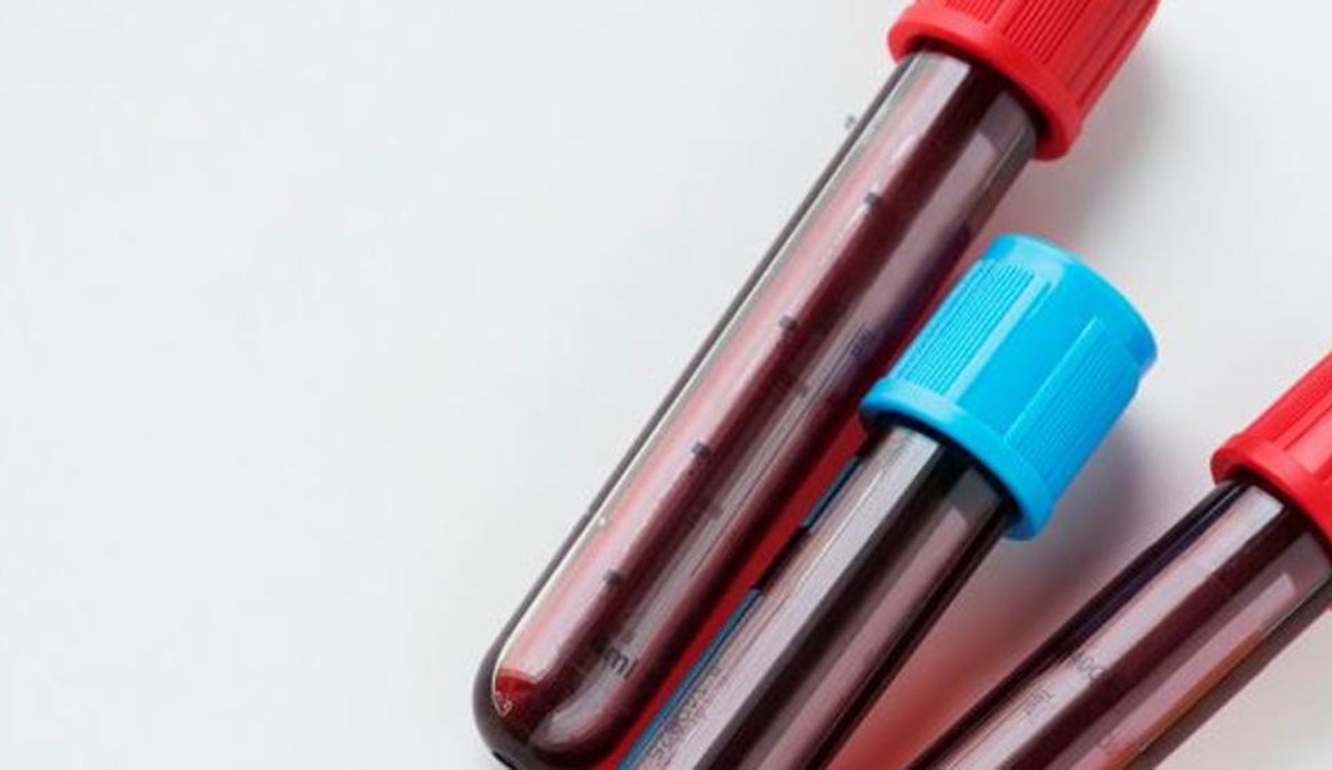 Análisis del PSA: qué es y para qué sirve – COEM CORPORATIVO DE ...