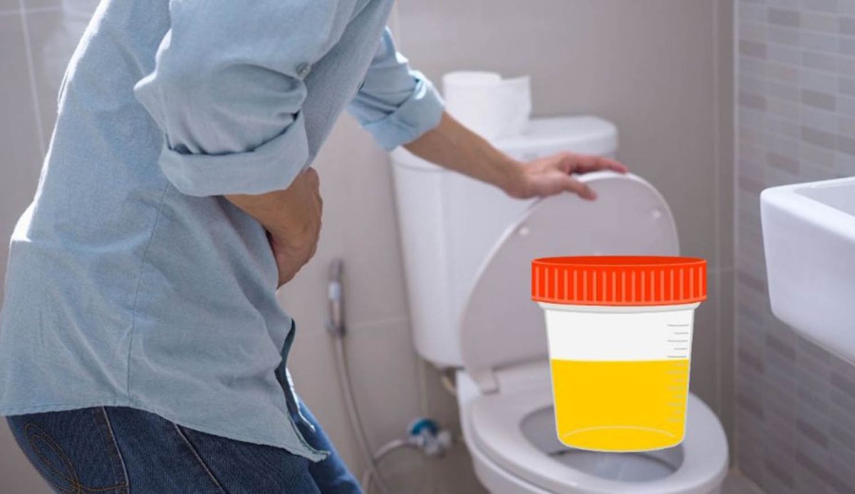 ¿Qué puede indicar el color de la orina? – COEM CORPORATIVO DE ...